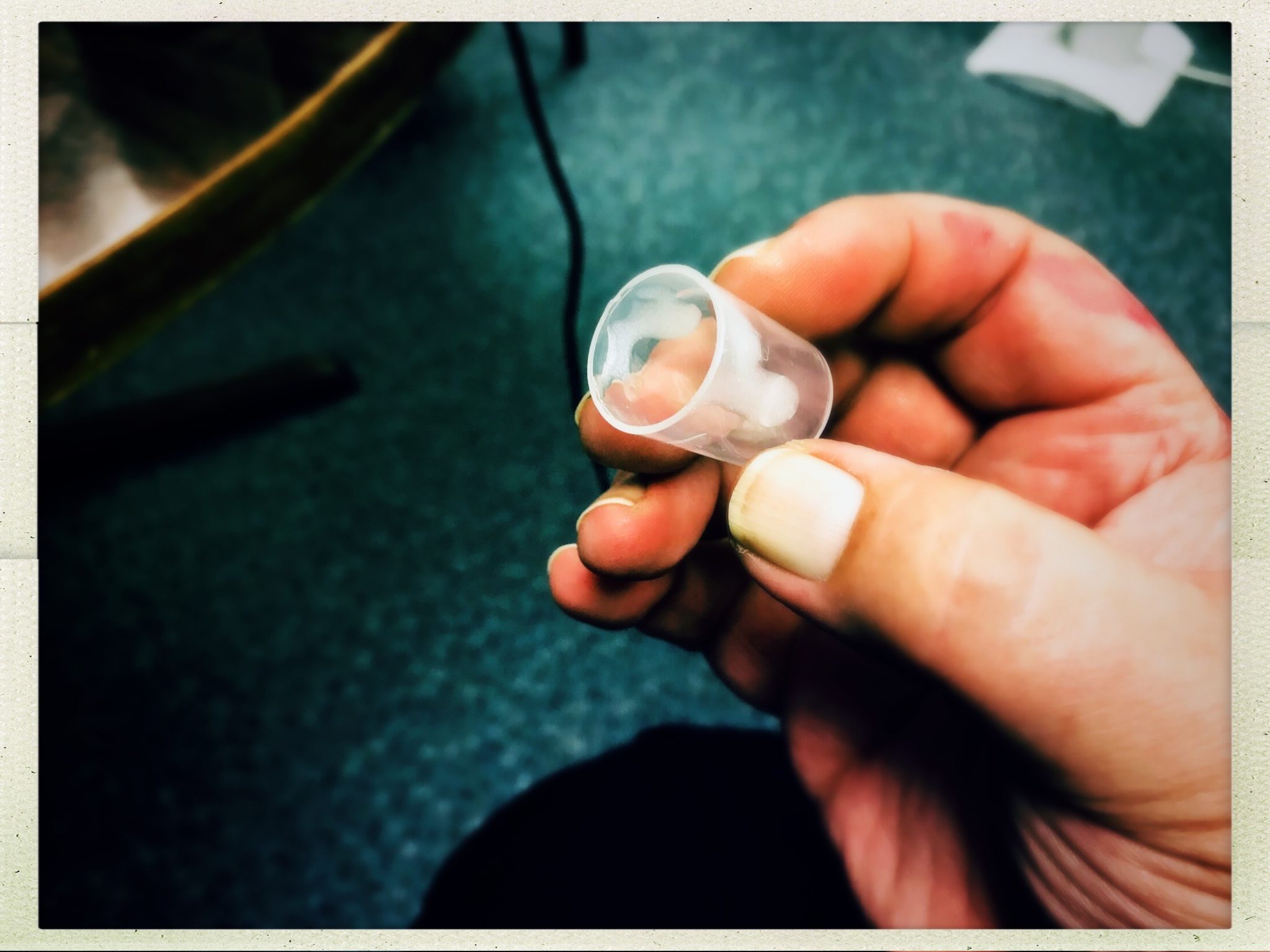 Photos show retraction process - eye-socket ectoplasm re-enters body ...